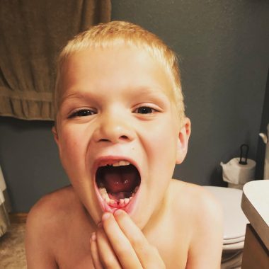 Nolan - First Tooth presented by Feil Orthodontics, Images, Video